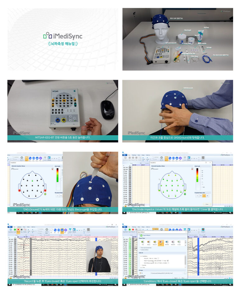 iMediSync 뇌파 검사 시연 영상 - 아이메디신 [ iMediSync ]